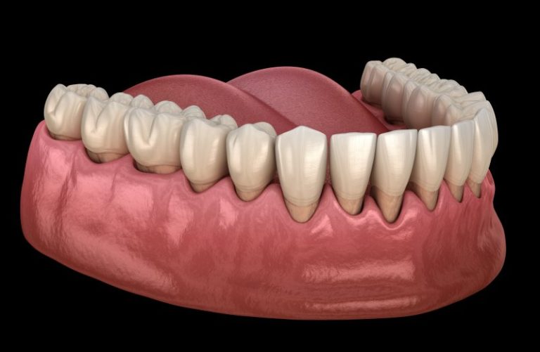Handsman Periodontics Blog
