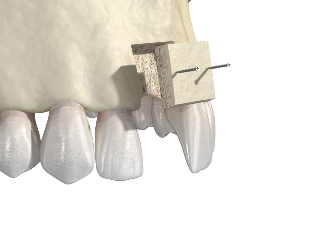 Handsman Periodontics Blog