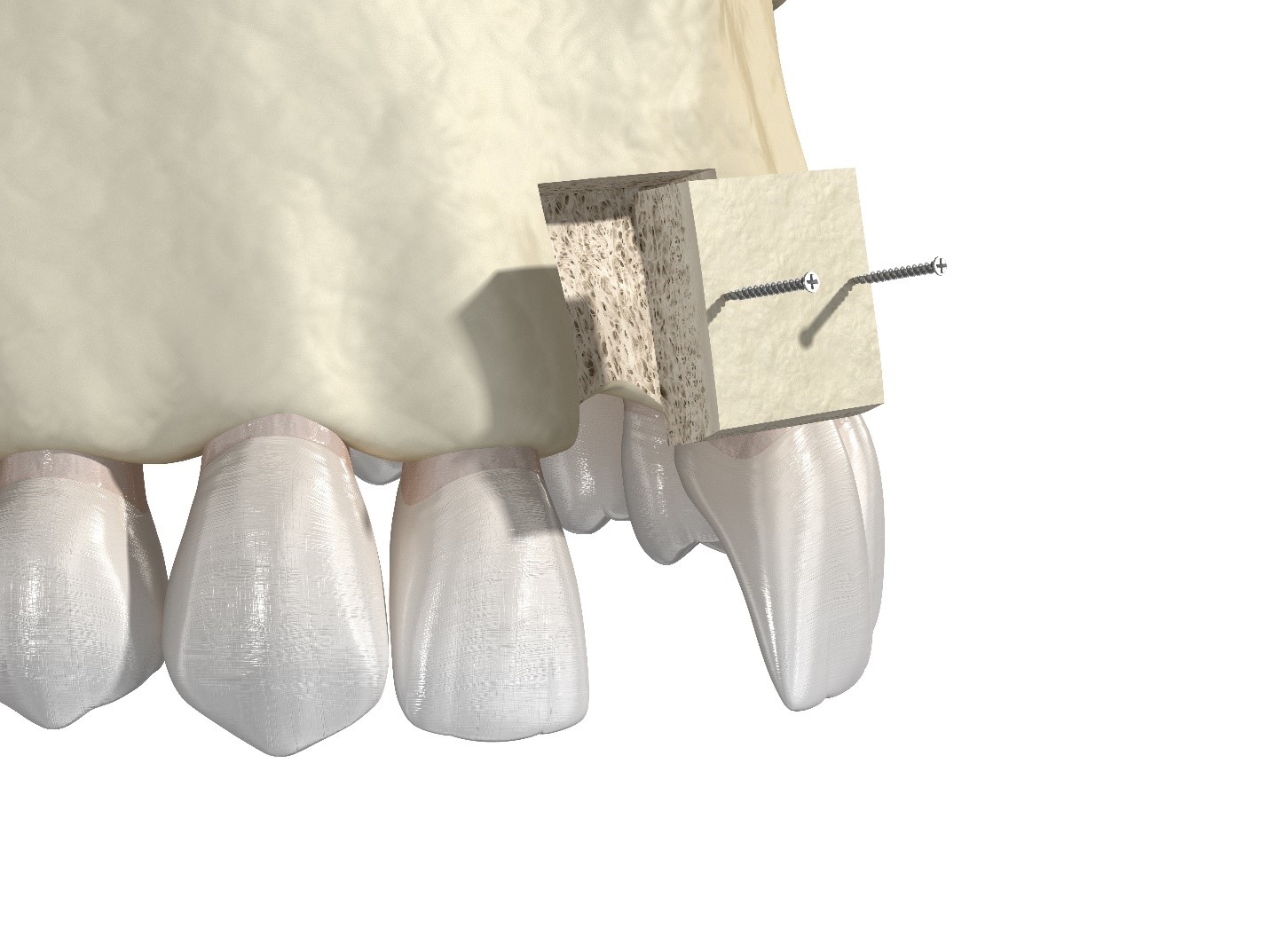 Handsman Periodontics Blog